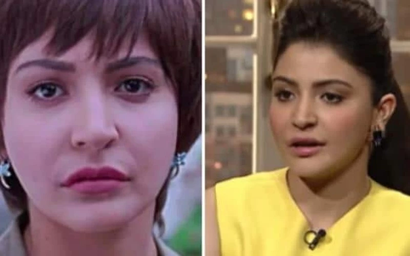 Anushka Sharma Before After