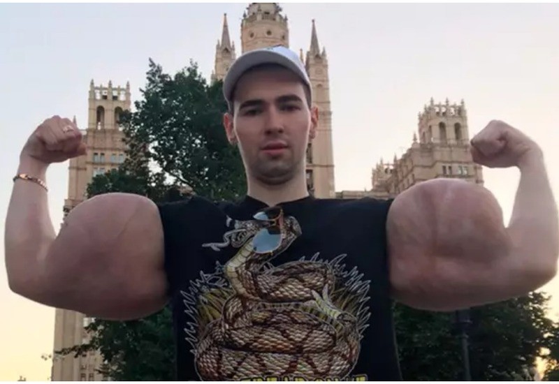 Russian Bodybuilder Forced to Surgically Remove Fake 24-inch oil ...