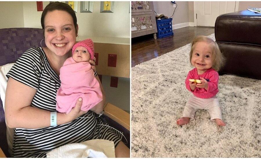 Weird news tiny toddler is born with rare form of dwarfism disability