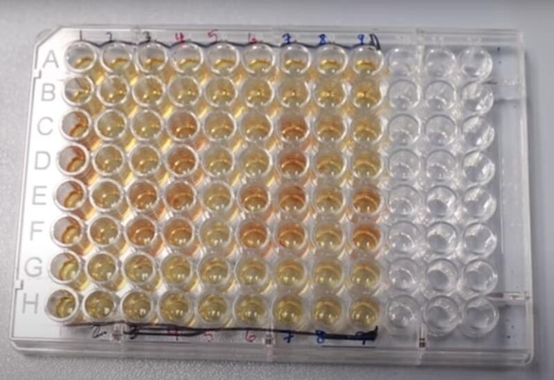 What is ELISA test that will be used to detect coronavirus antibody in ...