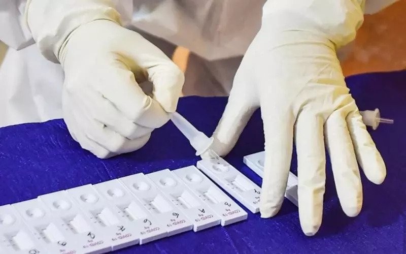 Omicron test kit OmiSure will be available in shops from today, know ...