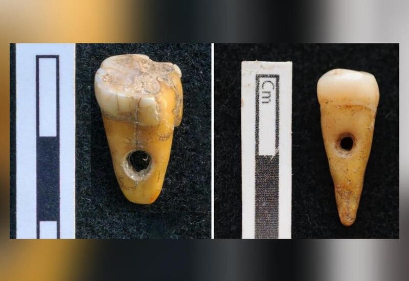2 human teeth used as jewellery 8500 years ago found in Turkey