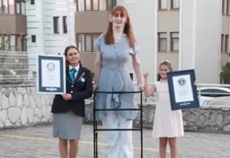 tallest living woman of world rumeysa gelgi of turkey